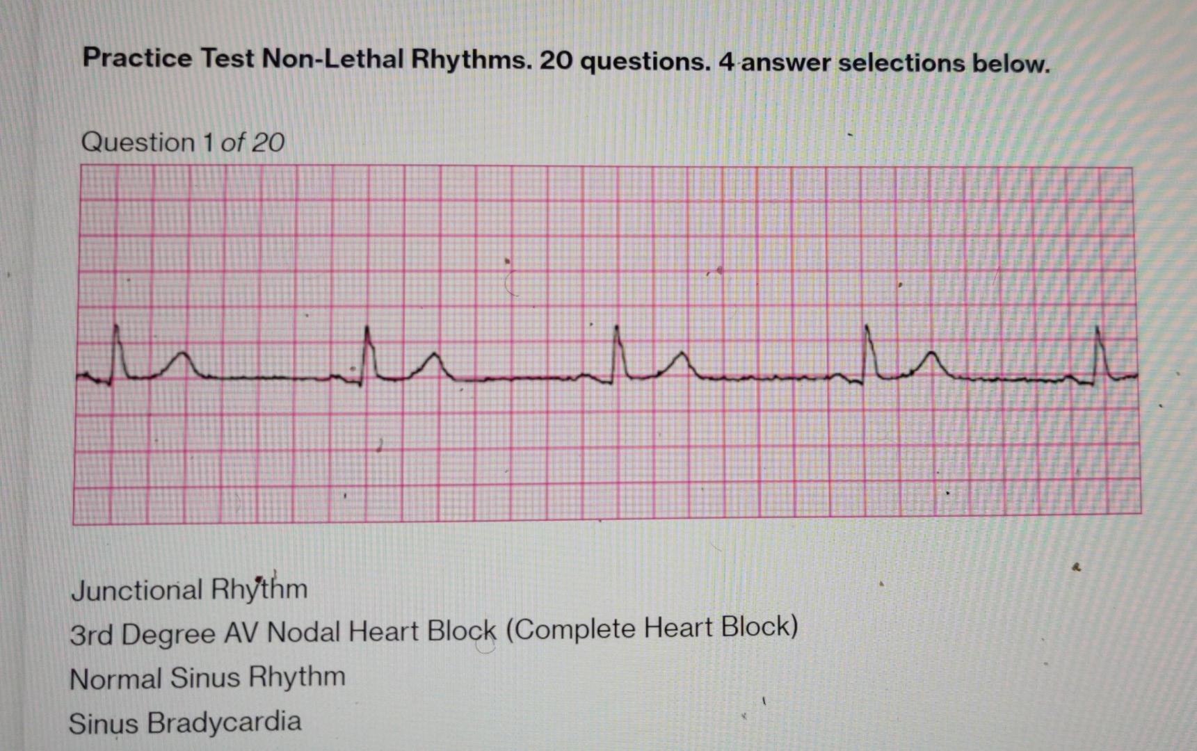 Solved Practice Test Non-Lethal Rhythms. 20 questions. 4 | Chegg.com