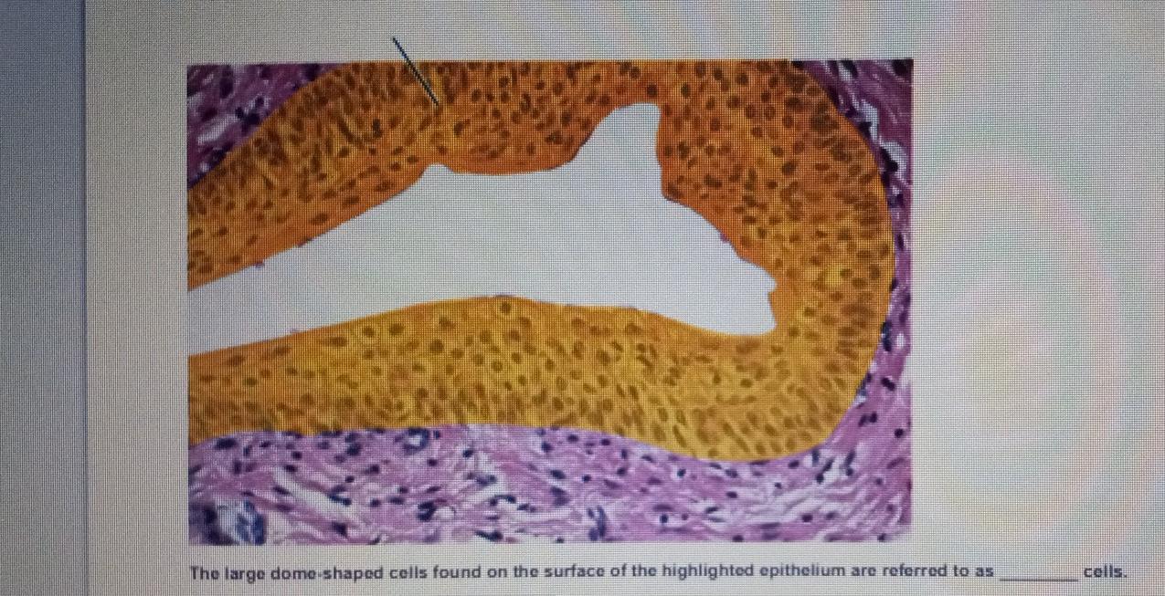 Solved the large done-shaped cells found on the surface of | Chegg.com