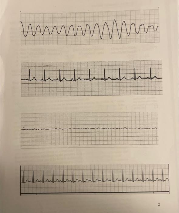 ECG strips. For each strip complete the 6 steps to | Chegg.com