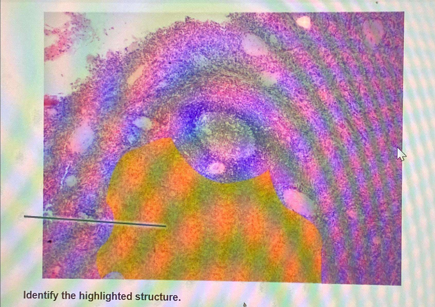 Solved Identify the highlighted structure | Chegg.com