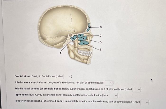 Solved Frontal sinus: Cavity in frontal bone (Label Inferior | Chegg.com