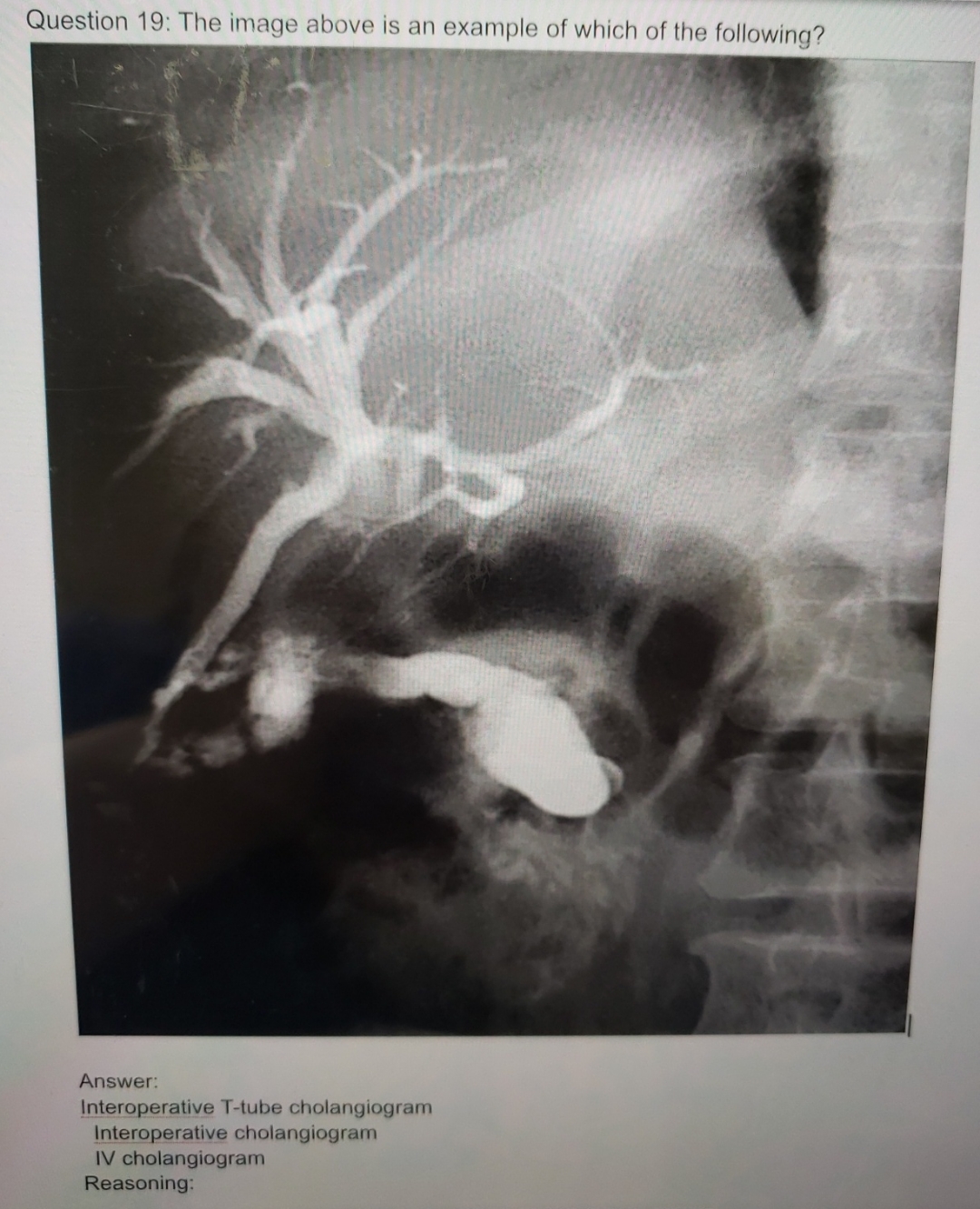 Solved The image shown is an example of which of the | Chegg.com