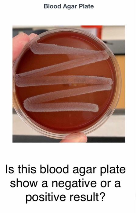 Solved Blood Agar Plate Is this blood agar plate show a | Chegg.com