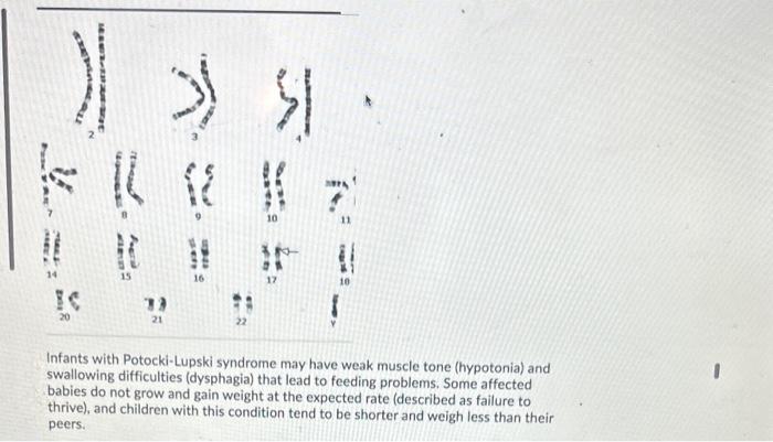 Solved Infants with Potocki-Lupski syndrome may have weak | Chegg.com