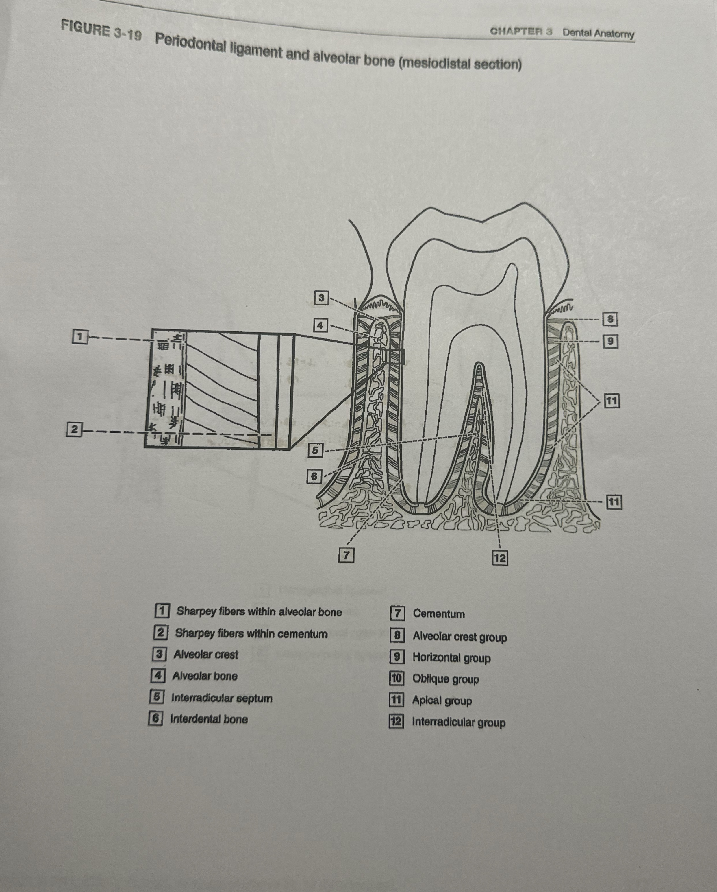 Solved CHAPTER 3 ﻿Dental AnatomyFIGURE 3-19 ﻿Periodontal | Chegg.com