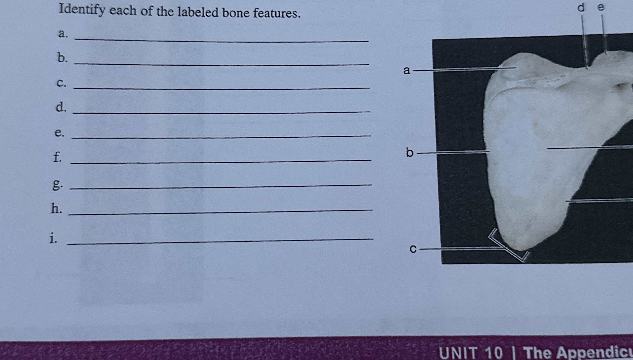 Solved Identify each of the labeled bone | Chegg.com