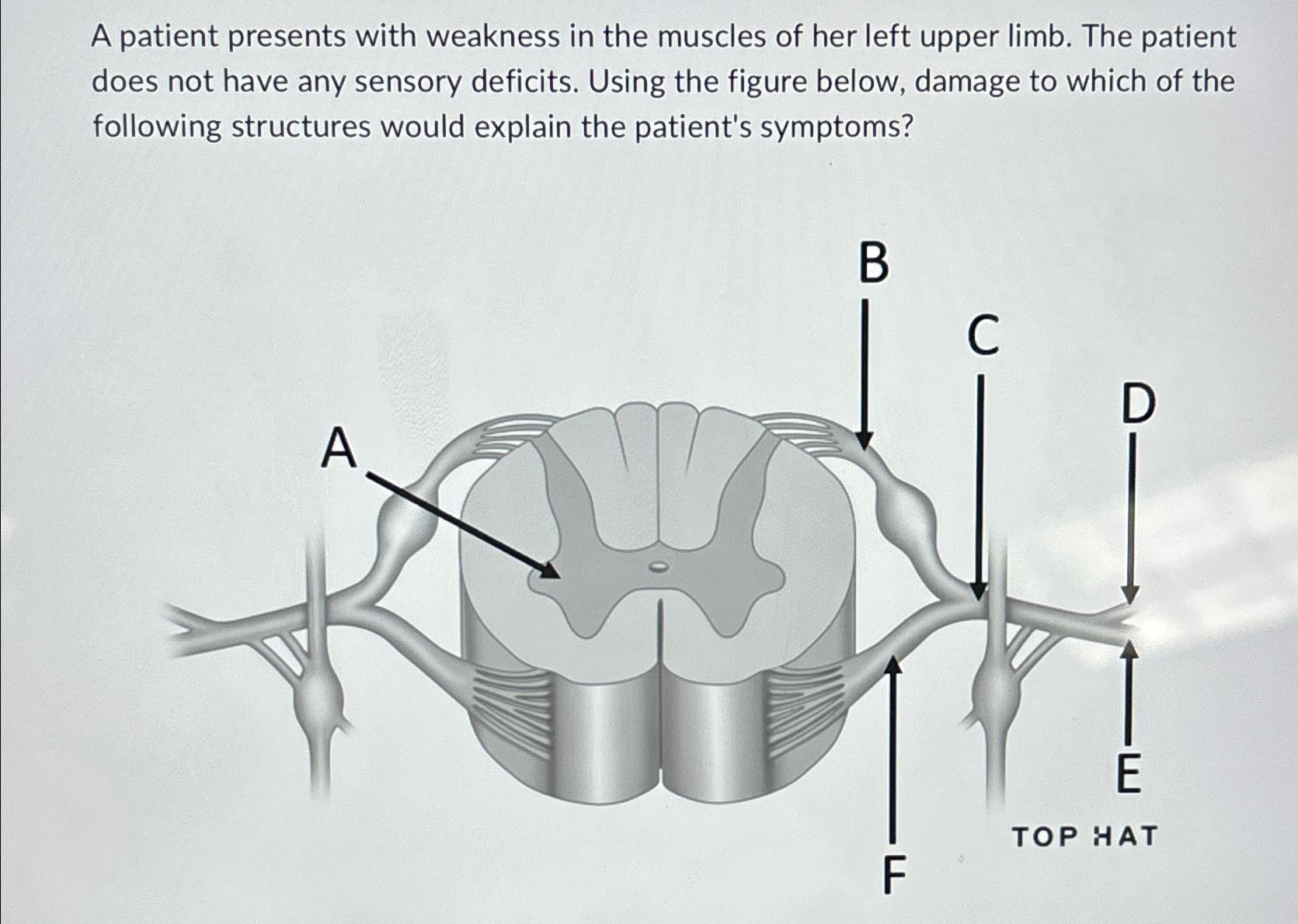 Solved A patient presents with weakness in the muscles of | Chegg.com