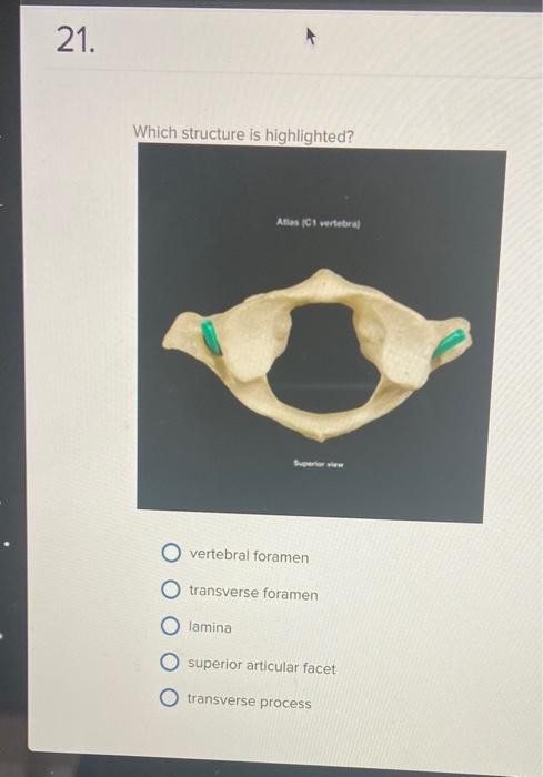 Solved 21. Which structure is highlighted? Atlas C1 | Chegg.com