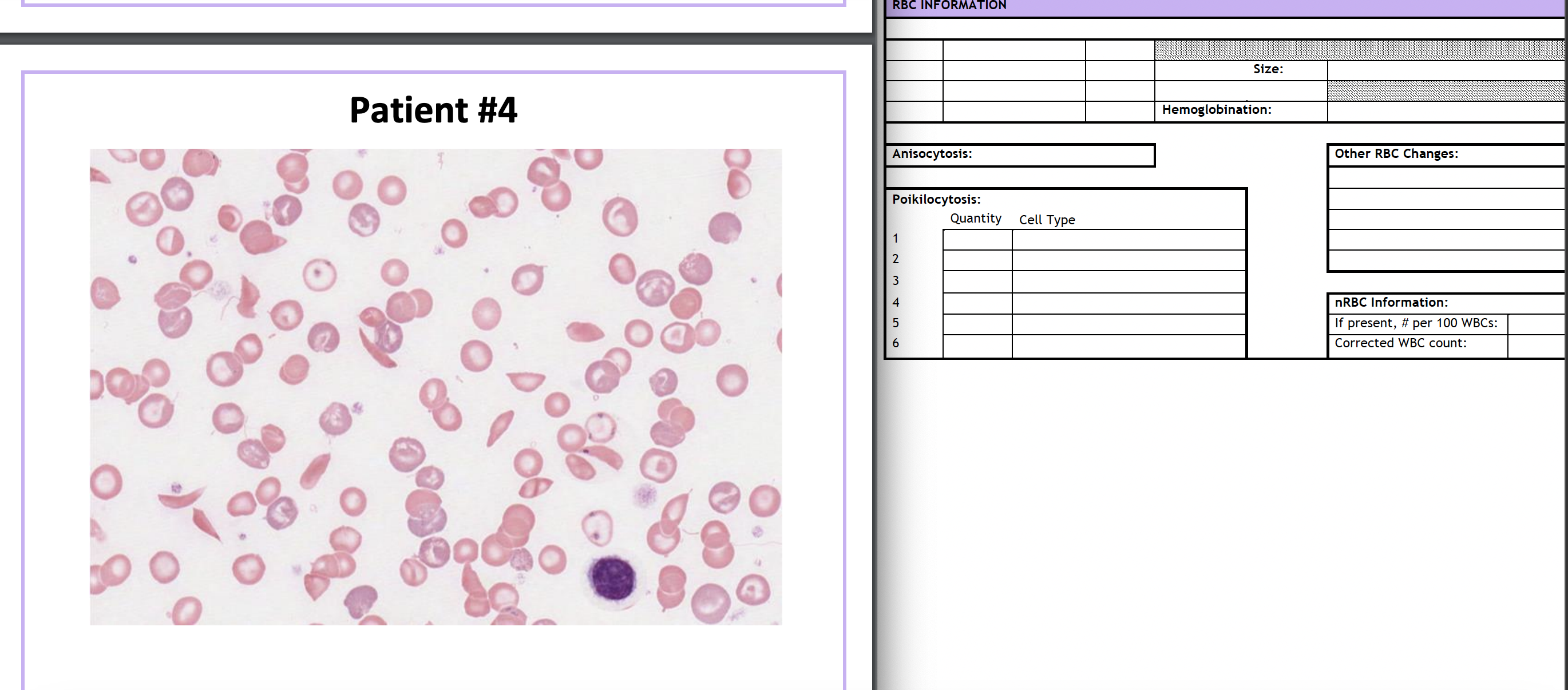 Solved Complete an RBC Morphology Scan for each patient For | Chegg.com