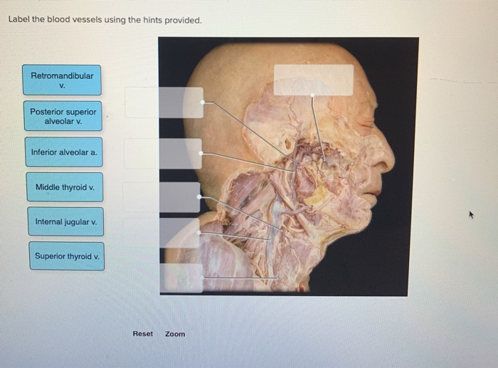 Solved Label the blood vessels using the hints provided. | Chegg.com