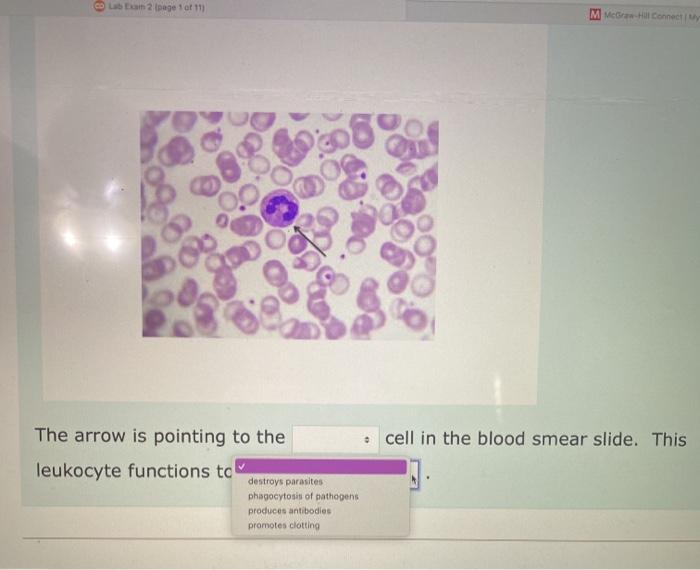 Solved The arrow is pointing to the cell in the blood smear | Chegg.com