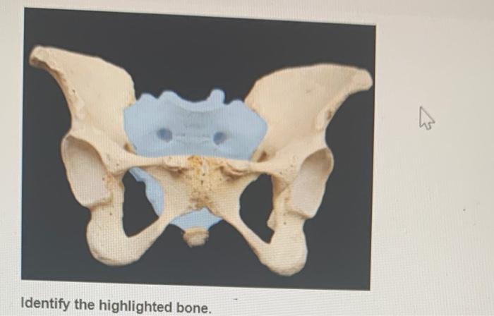 Solved Identify the highlighted bone. Identify the | Chegg.com
