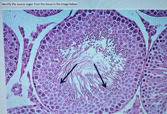 Solved Identify the source organ from the tissue in the | Chegg.com