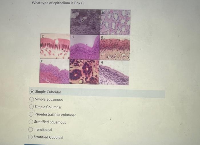 Solved What type of epithelium is Box C? Simple | Chegg.com
