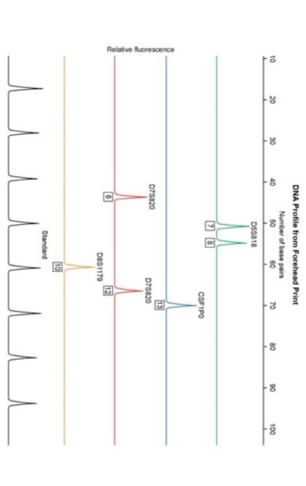 Solved 12 Compare The Suspects Dna Profile The