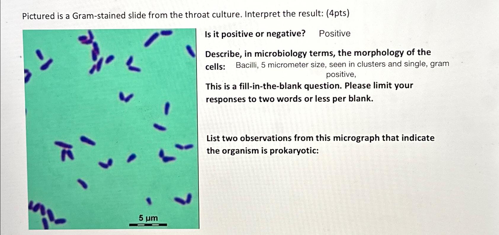 Solved Pictured is a Gram-stained slide from the throat | Chegg.com