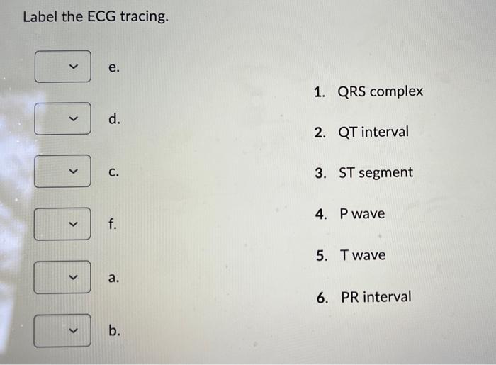 Solved Label the ECG tracing. Label the ECG tracing. e. 1. | Chegg.com