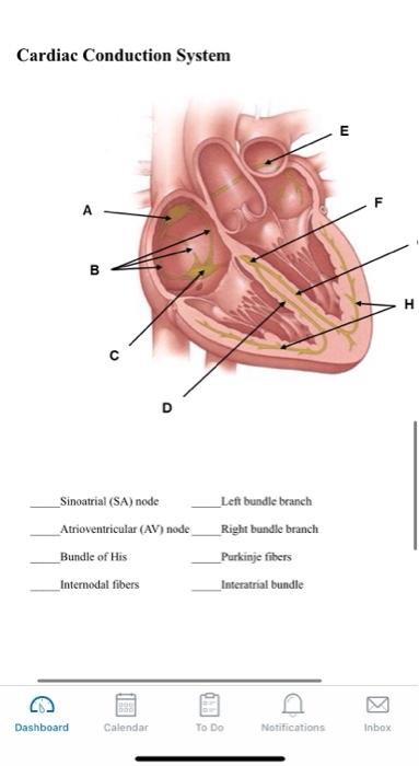 Solved Cardiac Conduction System E H Sinoatrial (SA) node | Chegg.com