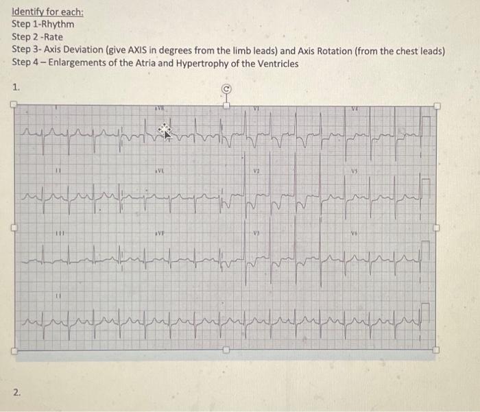 Identify for each: Step 1-Rhythm Step 2 -Rate Step | Chegg.com