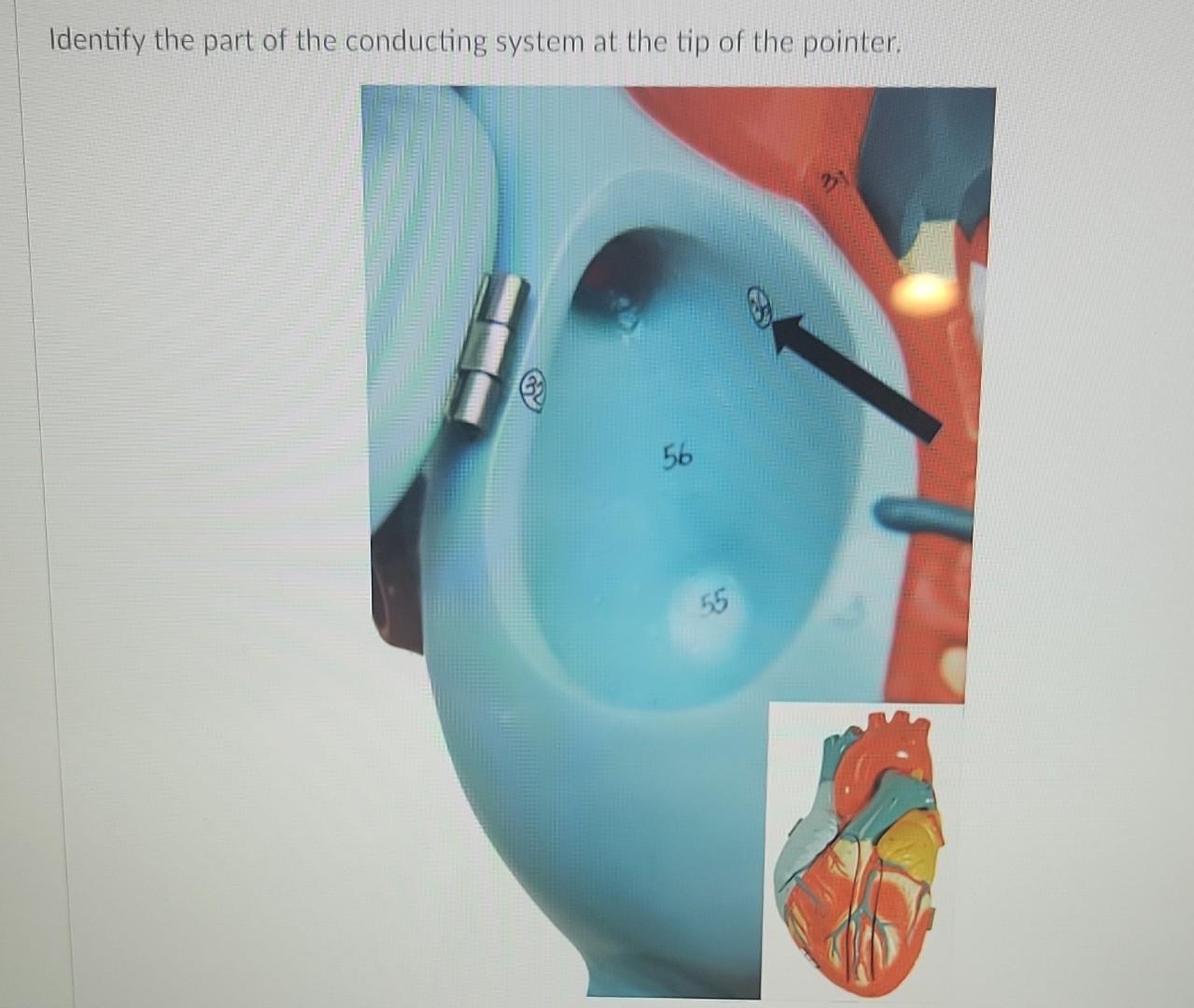 Solved Identify the part of the conducting system at the tip | Chegg.com