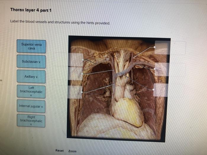Solved Thorax layer 4 part 1 Label the blood vessels and | Chegg.com