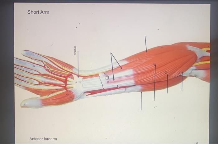 Solved Short Arm Anterior Full Upper Limb showing the medial | Chegg.com