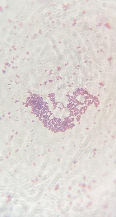 Solved list the possible bacterial microorganisms found on | Chegg.com