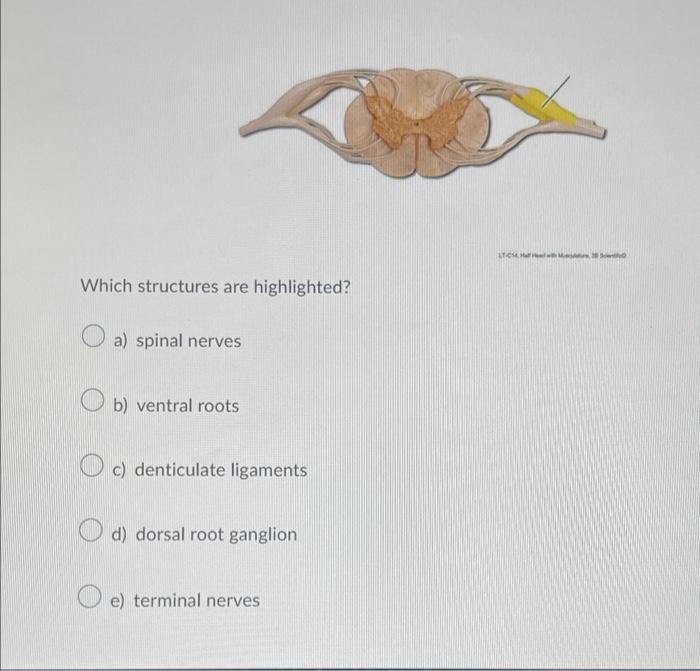 Solved Which structures are highlighted? a) spinal nerves b) | Chegg.com