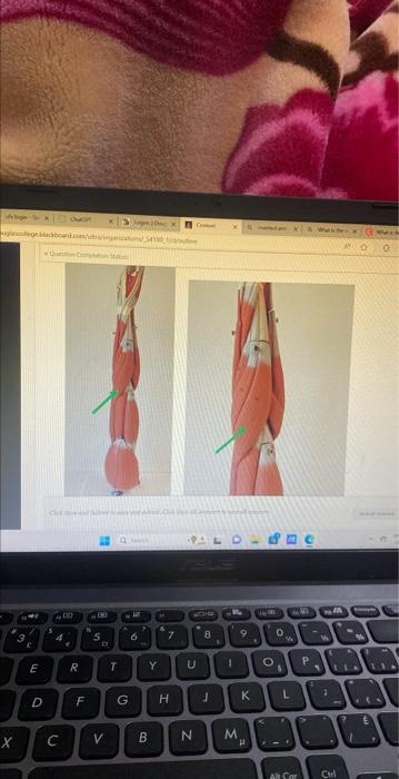 Solved name the muscle | Chegg.com