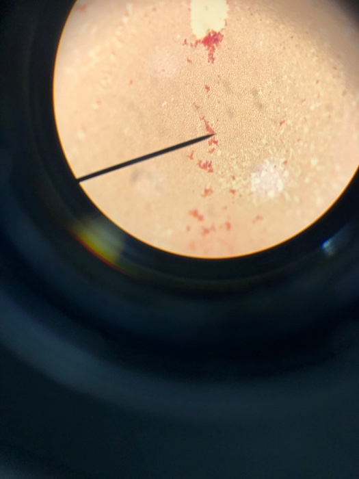 Solved I think my bacteria is enterobacter aerogenes/ k | Chegg.com