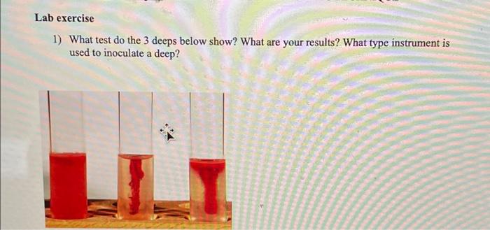 Solved Lab exercise 1) What test do the 3 deeps below show? | Chegg.com