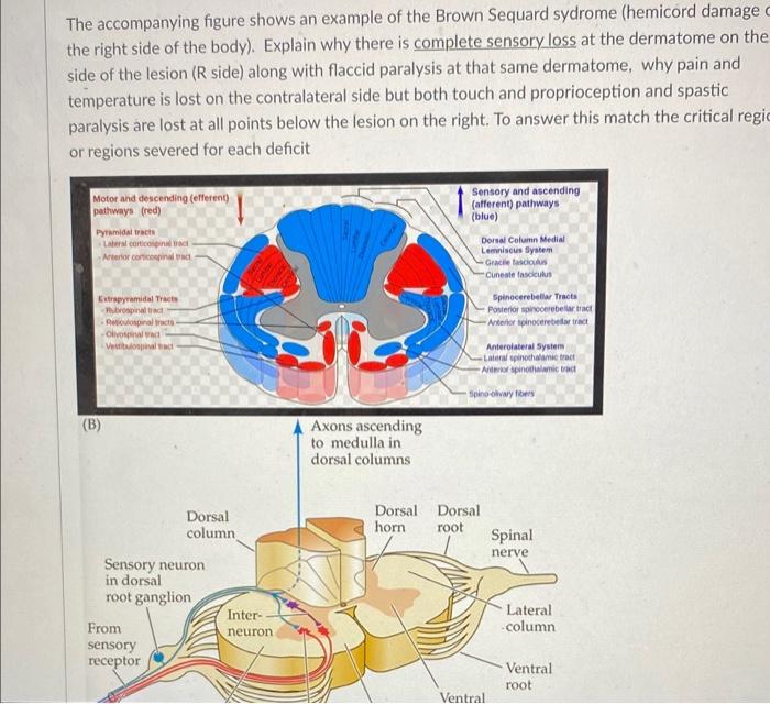 Solved The accompanying figure shows an example of the Brown | Chegg.com