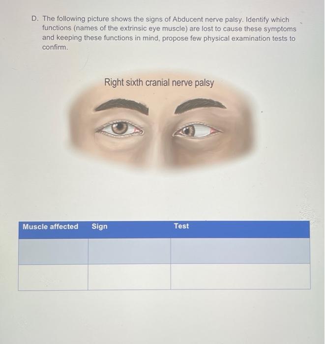 Solved D. The following picture shows the signs of Abducent | Chegg.com