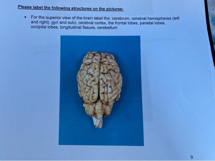 Solved Please label the following structures on the | Chegg.com