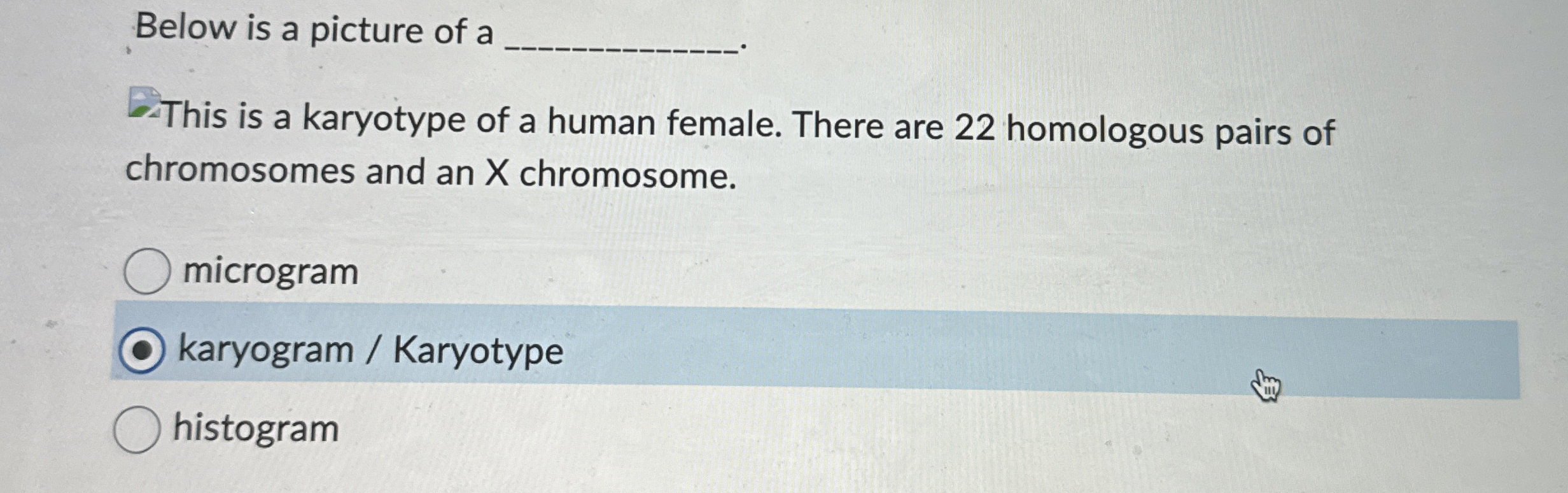 Solved Below is a picture of a This is a karyotype of a | Chegg.com