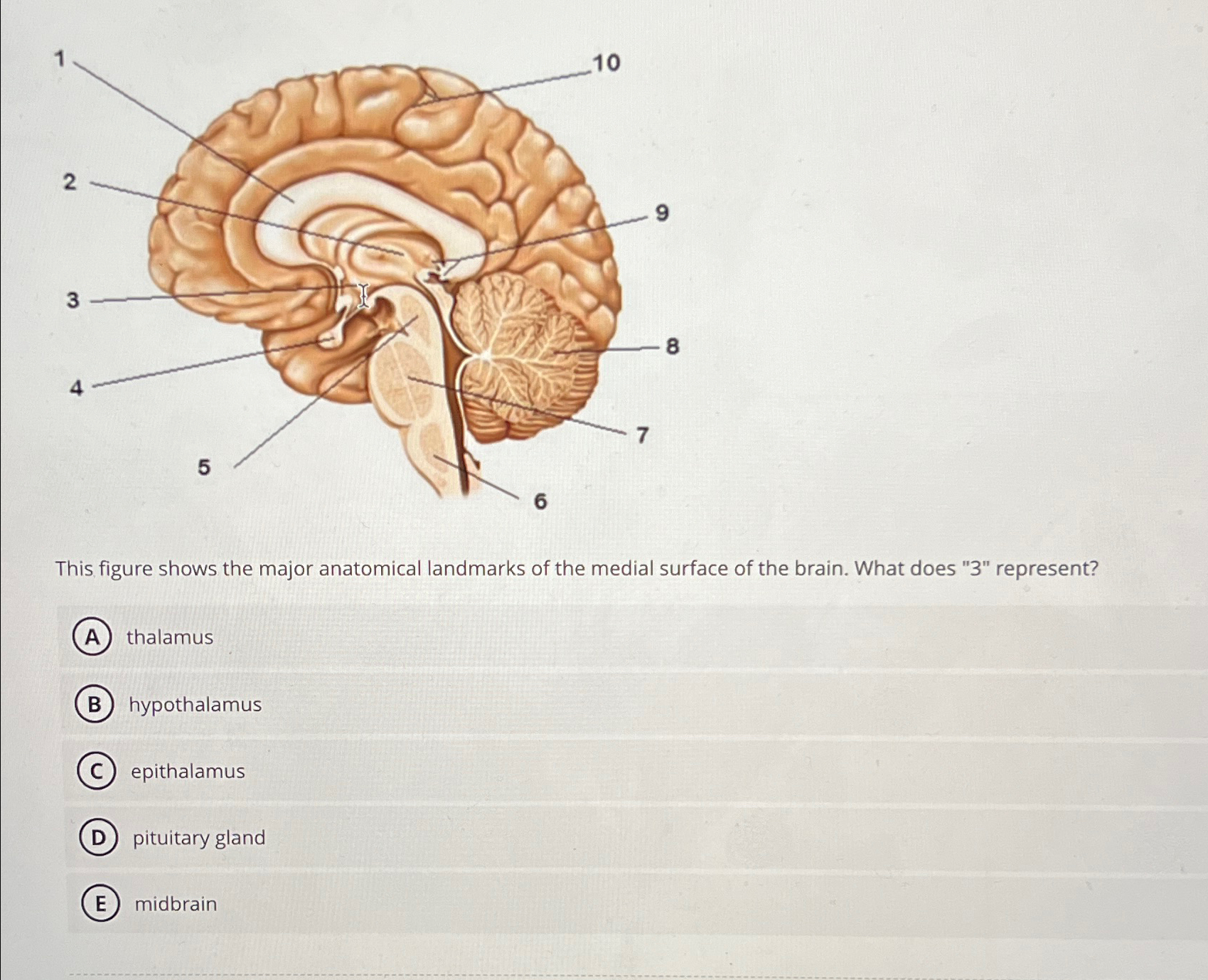 Solved This figure shows the major anatomical landmarks of | Chegg.com