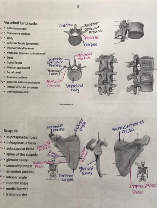 Solved Vertebral Landmarks Spinous process Transverse | Chegg.com