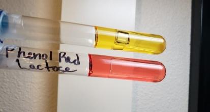 Solved What are the results of this lactose fermentation | Chegg.com