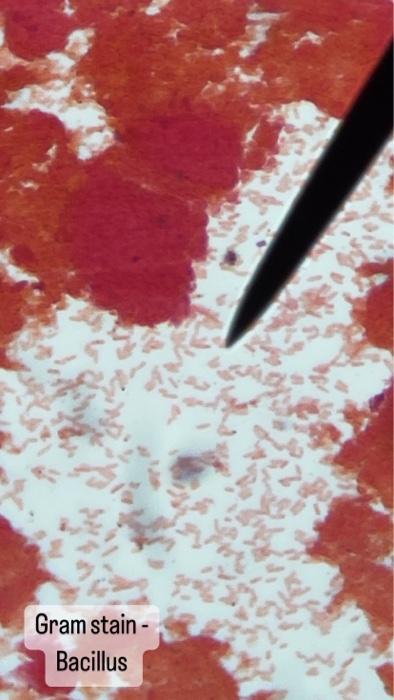 Solved can you help me identify the unknown bacteria using | Chegg.com