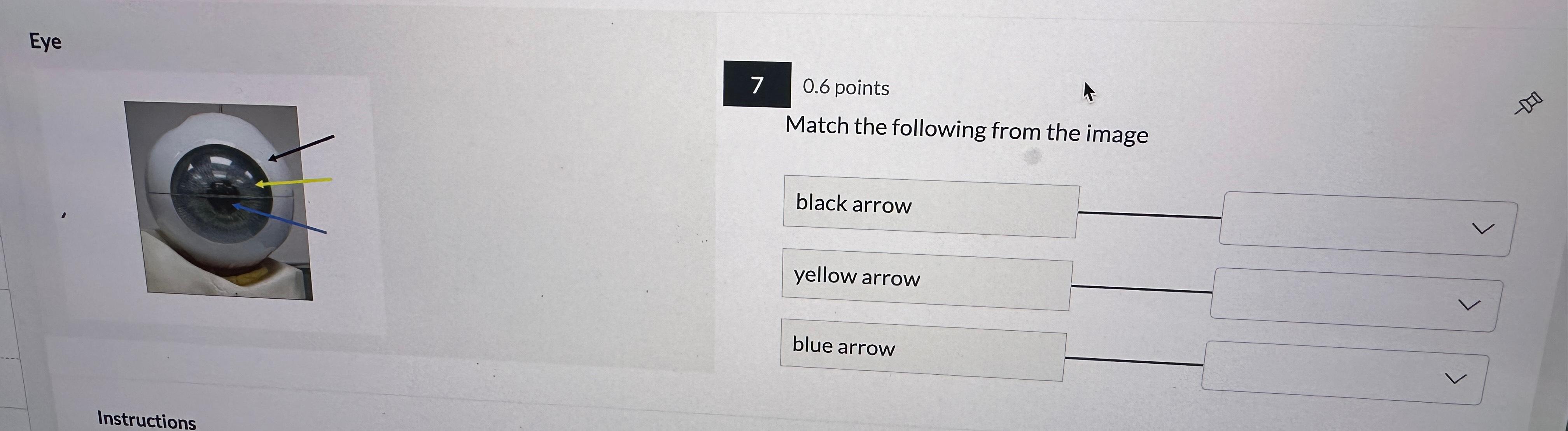 Solved Eye7,0.6 ﻿pointsMatch the following from the | Chegg.com