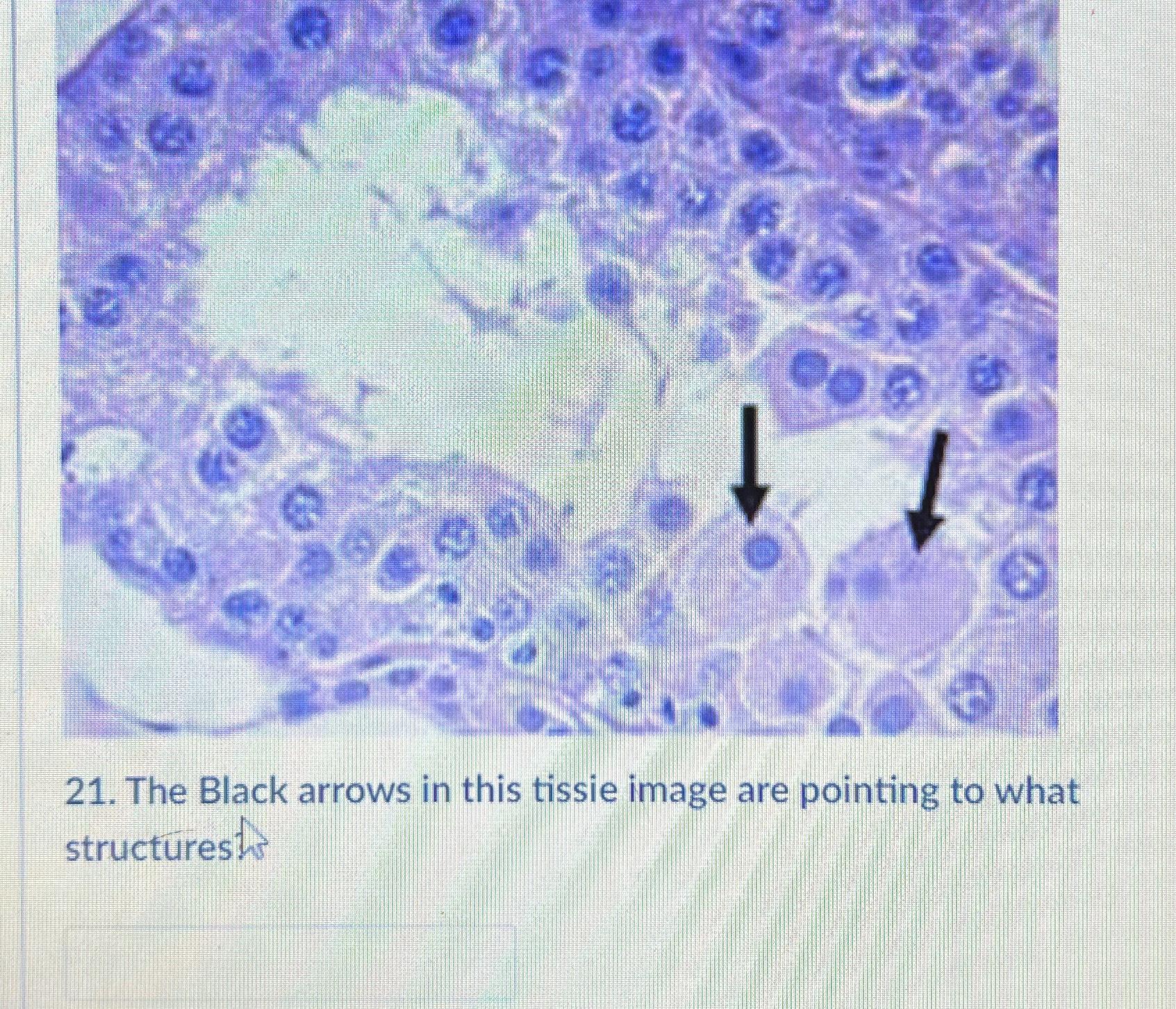 Solved The Black arrows in this tissie image are pointing to | Chegg.com