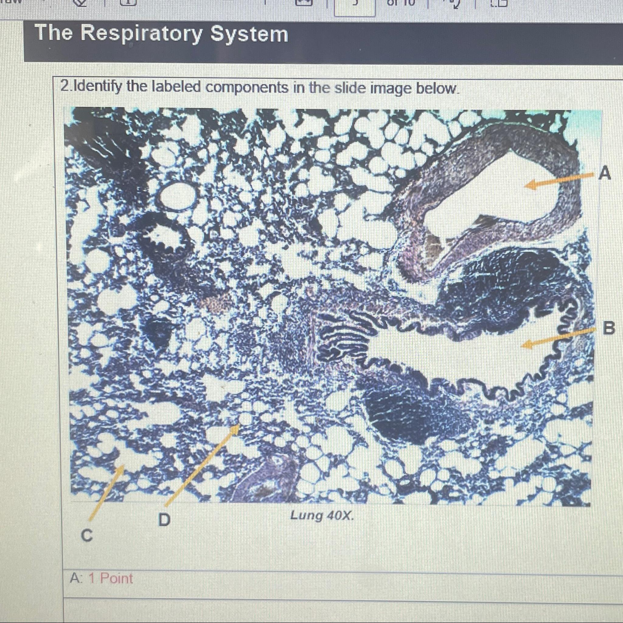 Solved The Respiratory System | Chegg.com