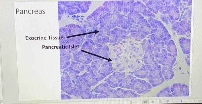 Solved Pancreas Exocrine Tissue Pancreatic Islet Note | Chegg.com