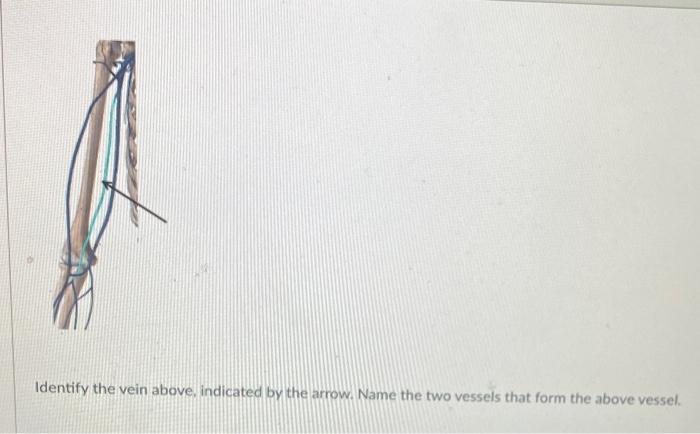 Solved Identify the vein above, indicated by the arrow. Name | Chegg.com
