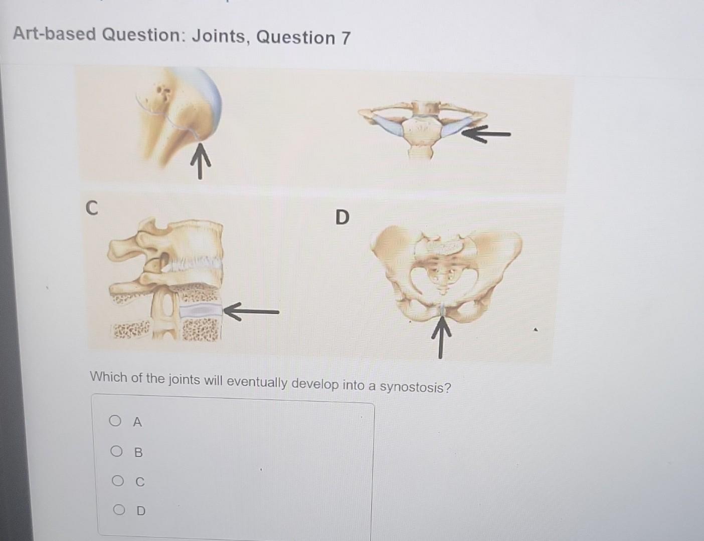Solved Art-based Question: Joints, Question 7 Which of the | Chegg.com