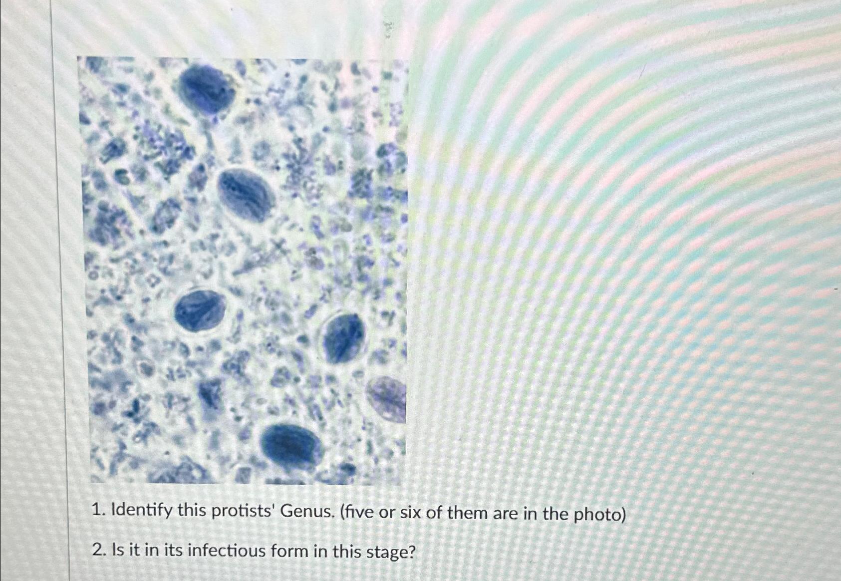 Solved Identify this protists' Genus. (five or six of them | Chegg.com
