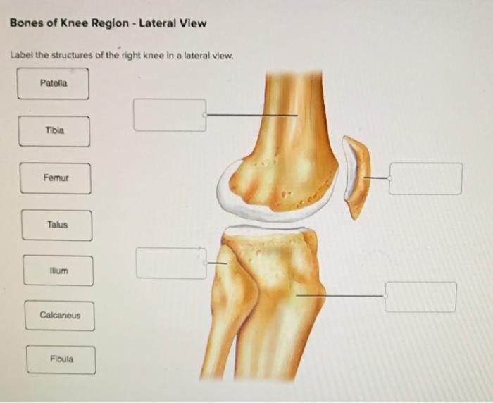 Solved Bones of Knee Region - Lateral View Label the | Chegg.com