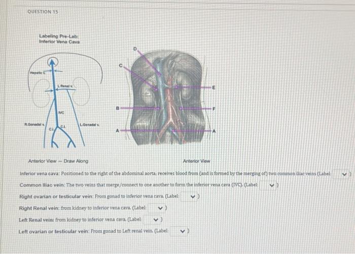Solved Question 15 Label Pre-lab:Inferior Vena Cava inferior | Chegg.com