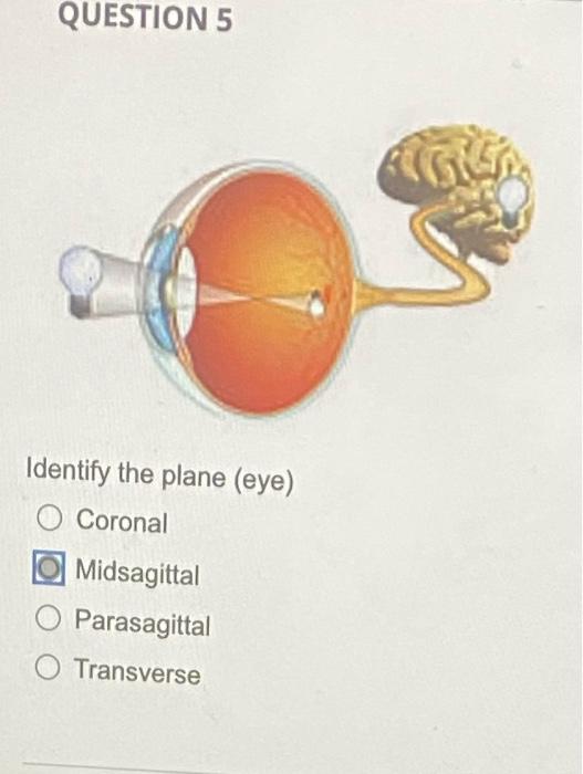 Solved Identify the plane (eye) Coronal Midsagittal | Chegg.com