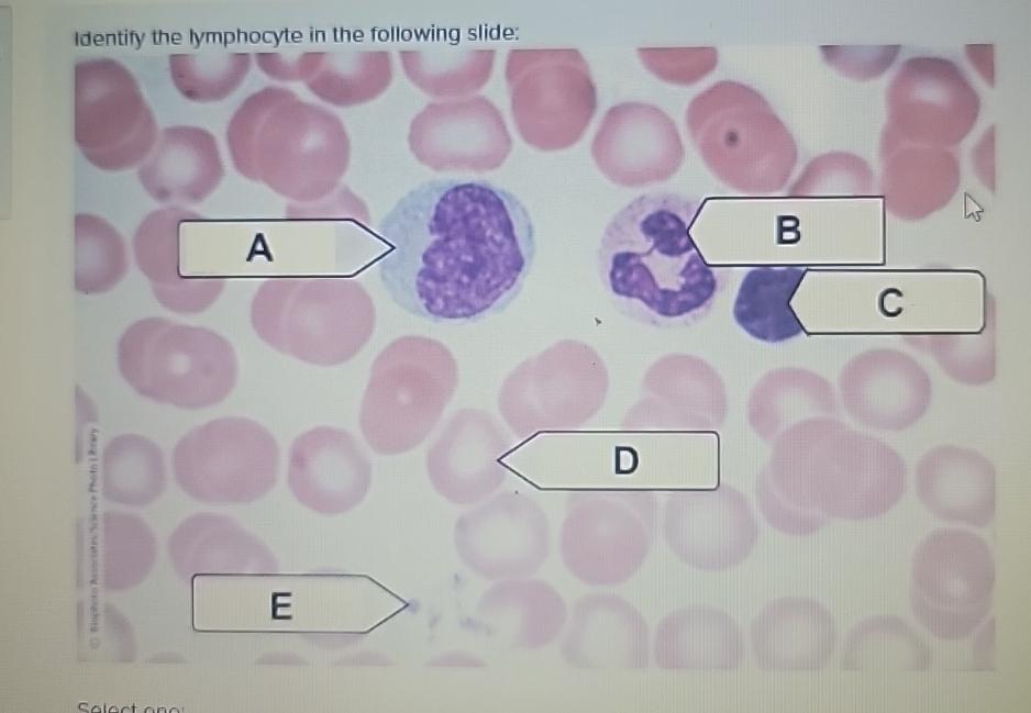 Solved Identify the lymphocyte in the following slideAC | Chegg.com